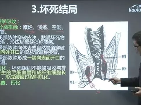 考拉网临床执业医师第一节 细胞、组织的适应、损伤和修复(2)