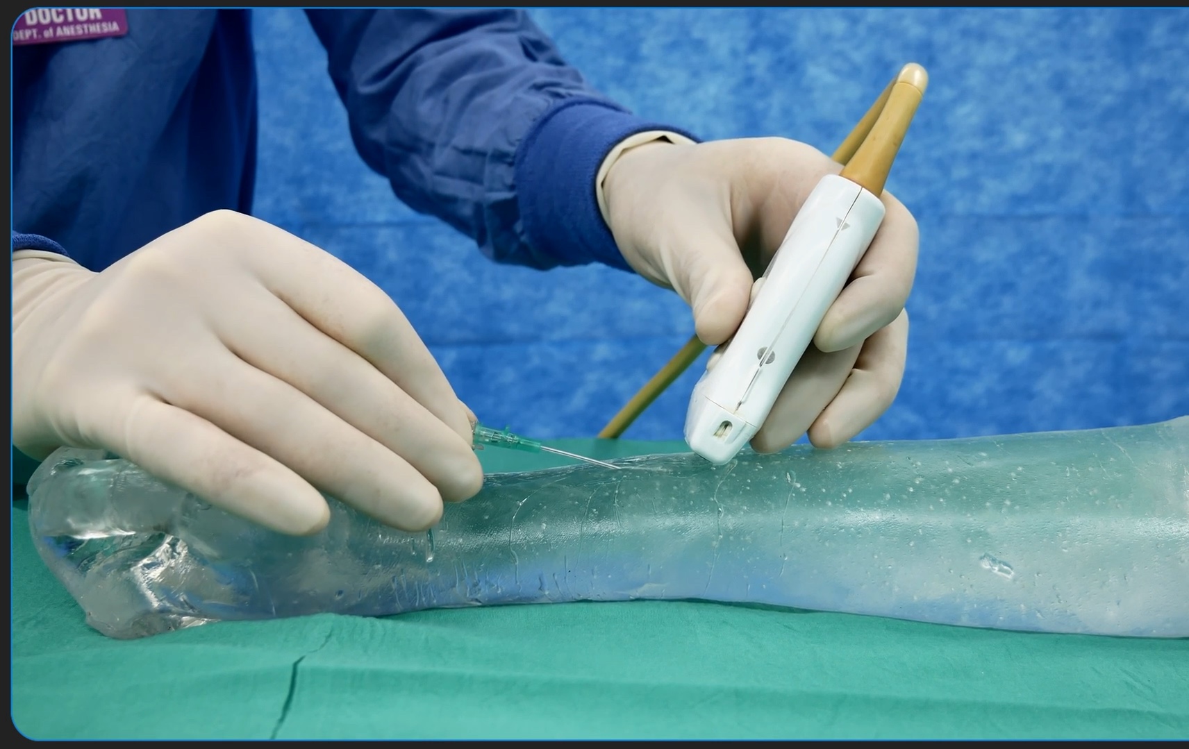 超声引导下动脉置管