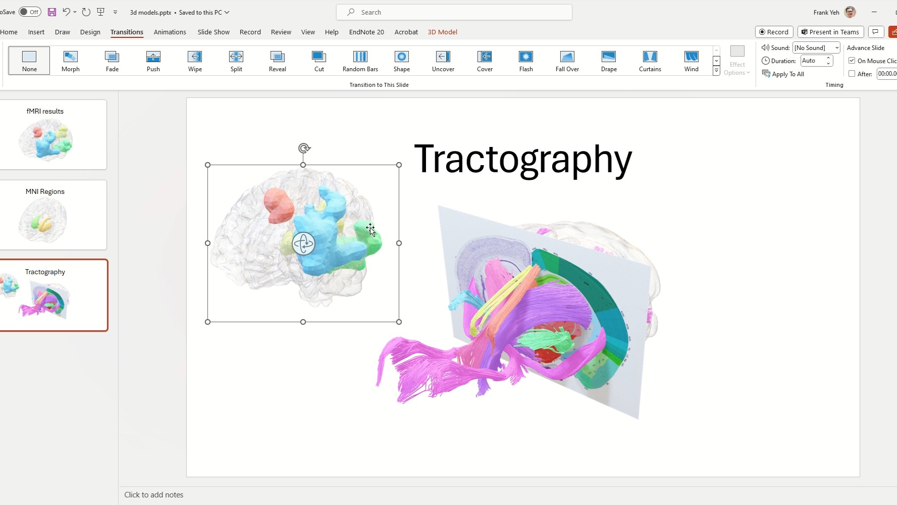 DSI-Studio 短教程: ptt簡報中加入大腦3D模型