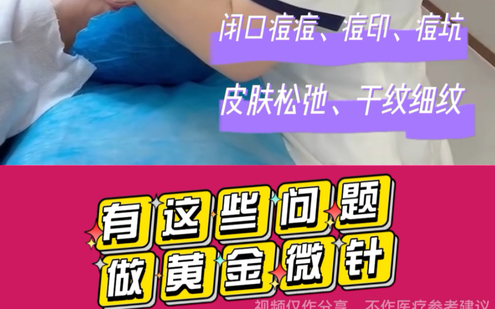 黄金射频微针都能解决哪些问题呢? 出油多、屏障功能下降、毛孔粗大...