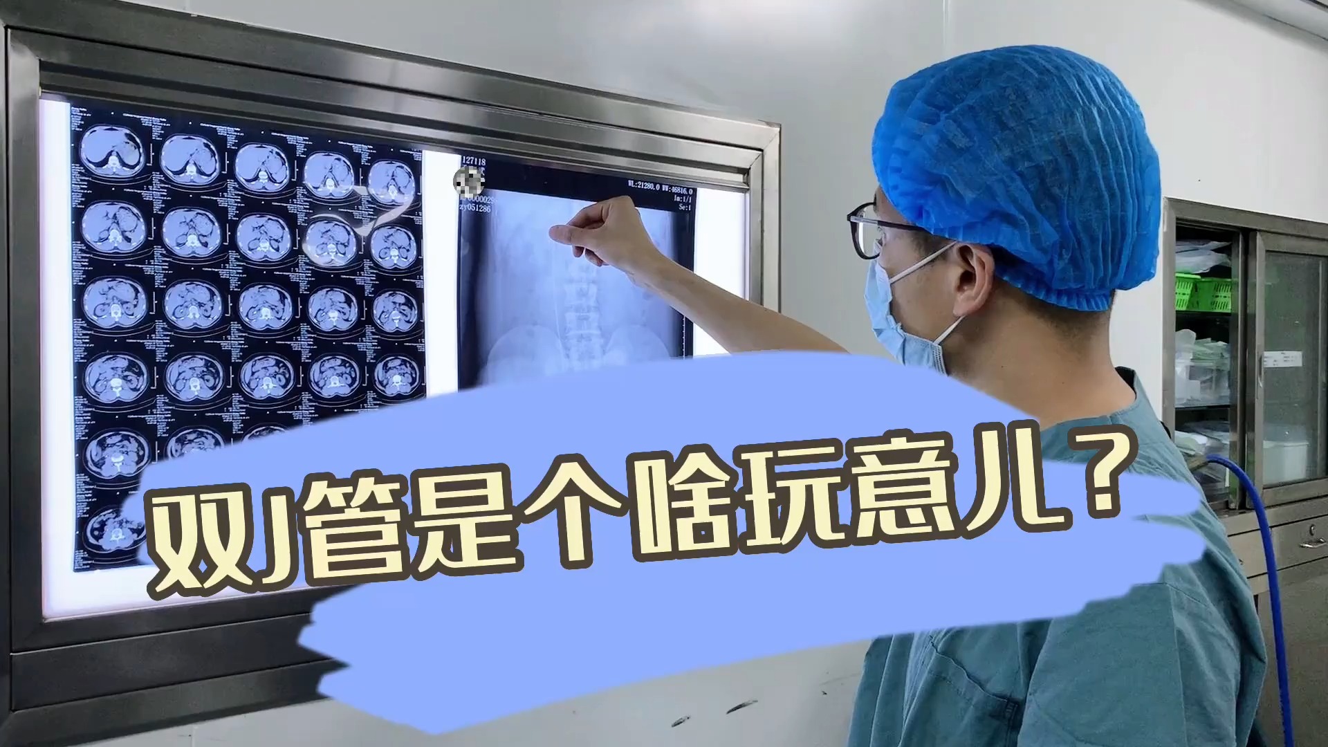 【重庆结石病医院】肾结石手术里的双J管到底是什么玩意儿?!为什么...