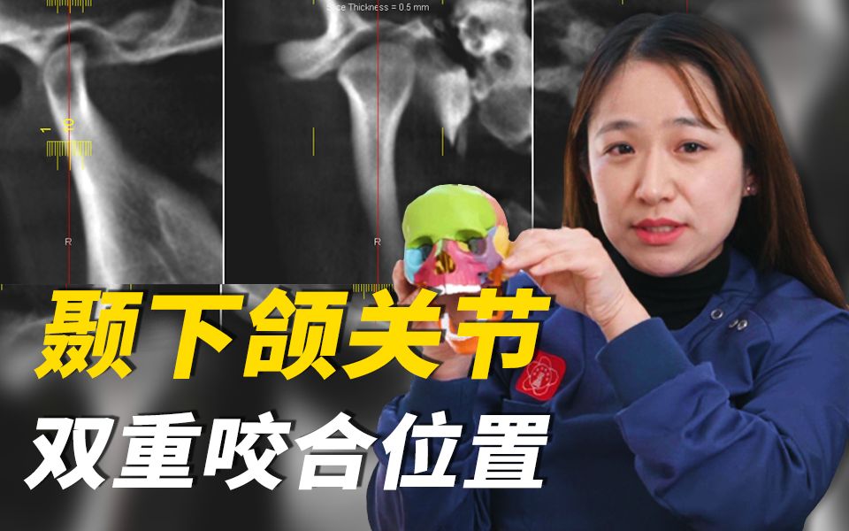 咬合不舒服?常被正畸医生忽视的CR-CO不调是什么?