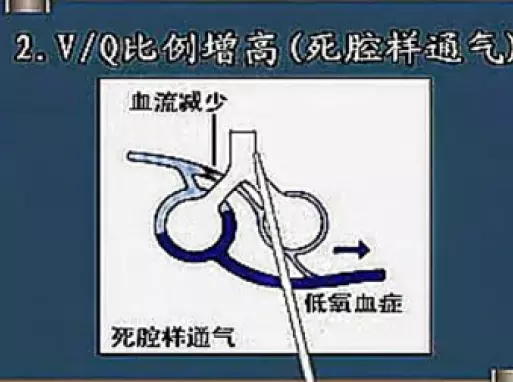 病理生理学 北京大学医学部12_标清
