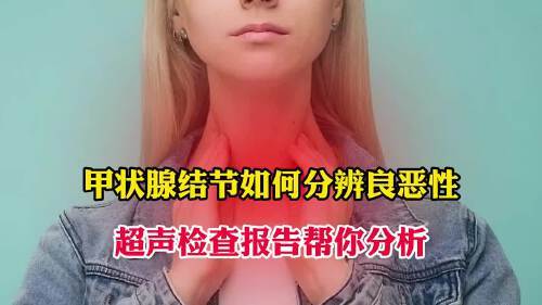 甲状腺结节如何分辨良恶性,超声检查报告帮你分析
