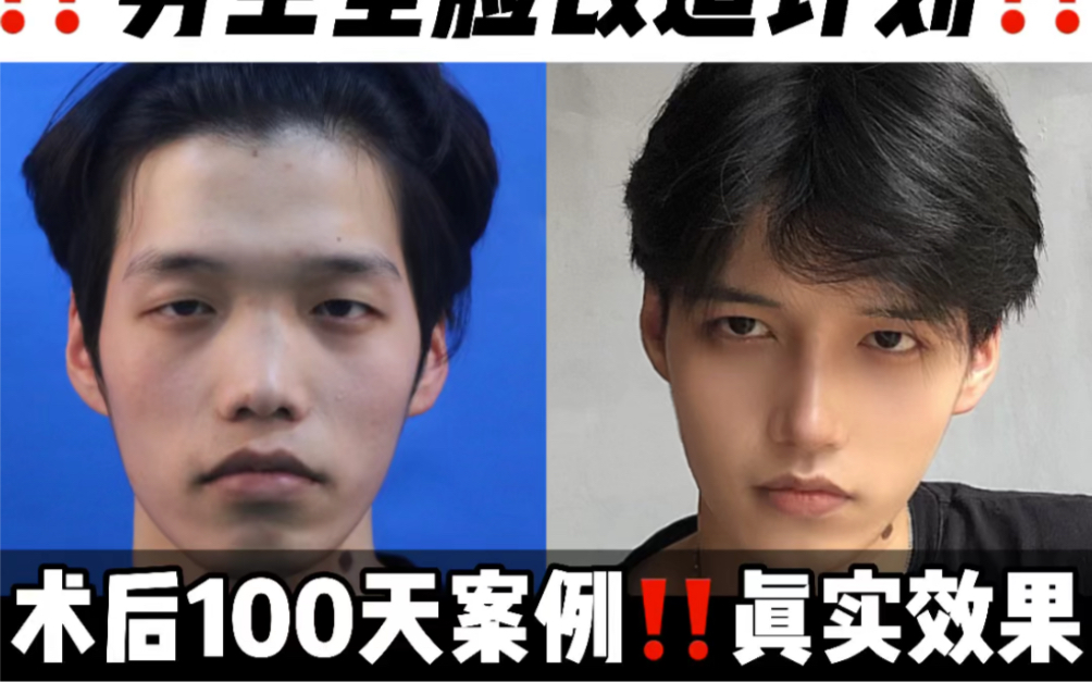 暑期如何变帅⁉️男生改造计划颜值逆袭全记录