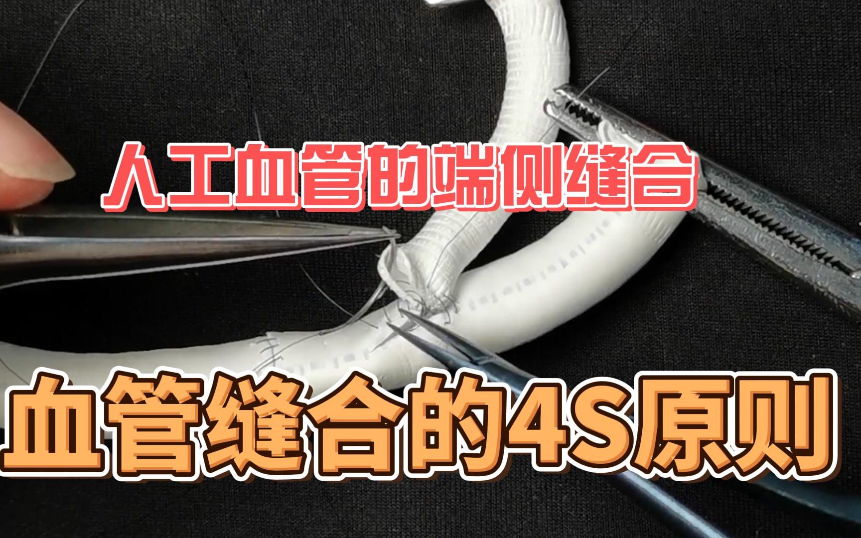 血管的缝合训练7:人工血管的端侧缝合|血管缝合的4S原则
