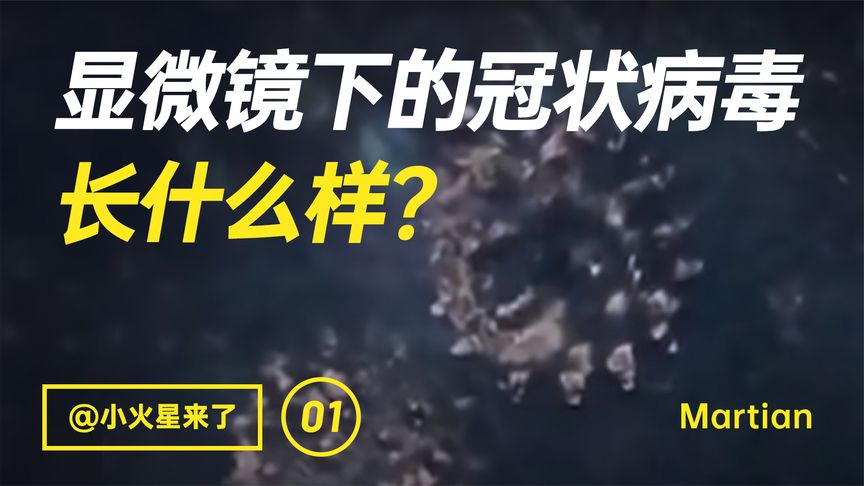 显微镜下的冠状病毒是怎样的?你只能在显微镜下看到的 10 件事