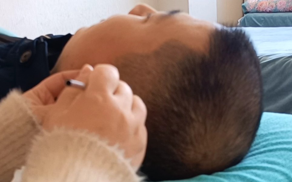 患有霉菌性中耳炎的顾客总能掏出大货,采耳师很有成就感!