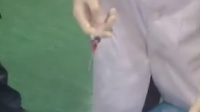 颈静脉穿刺