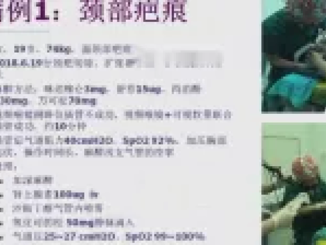 第192讲:可视软镜在困难气管插管的应用(邓晓明教授)