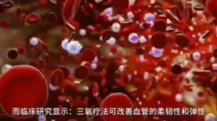 .血管为什么会堵我们应该注意些什么三氧大自血疗法来帮你!健康管理...