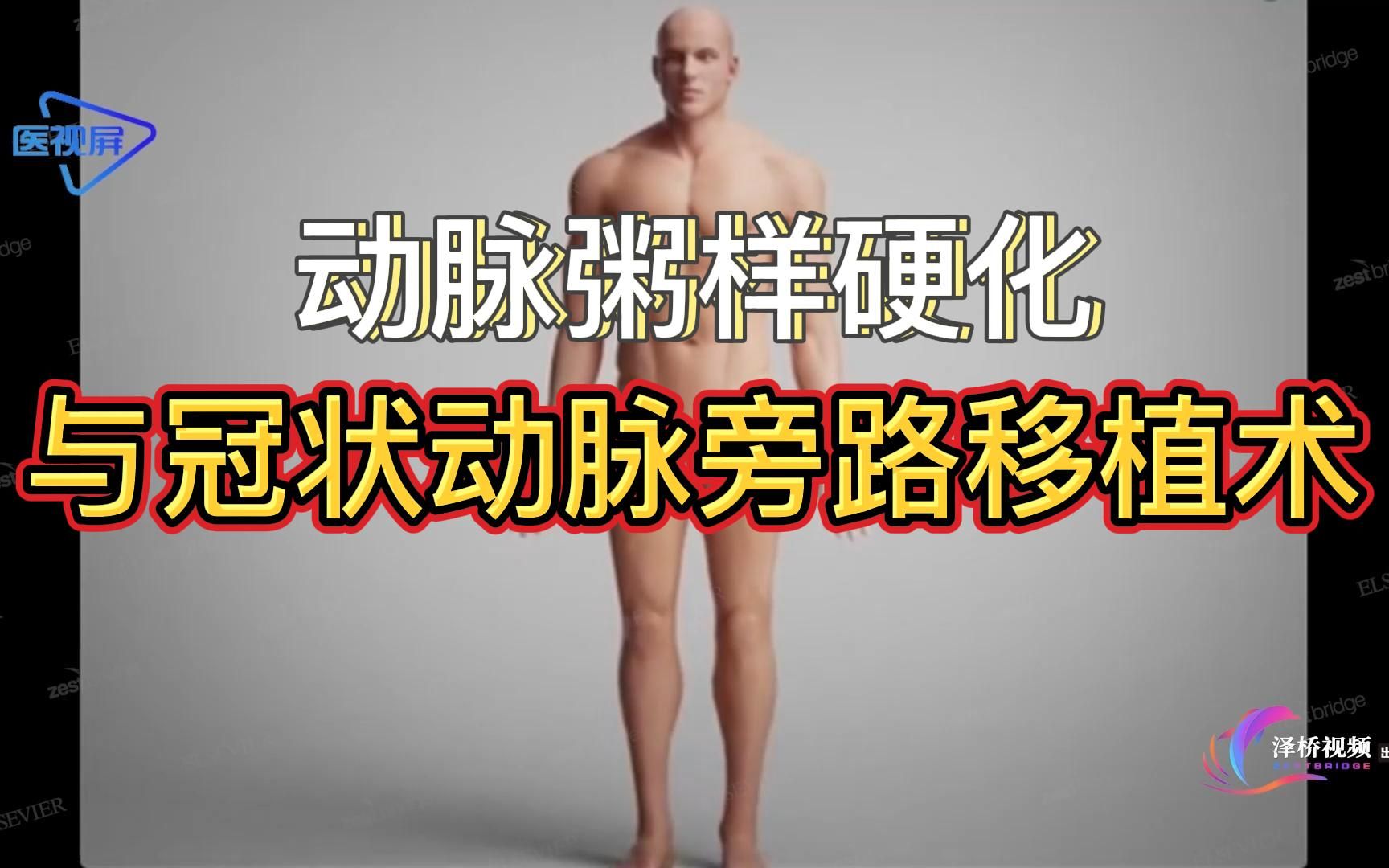 动脉粥样硬化与冠状动脉旁路移植术