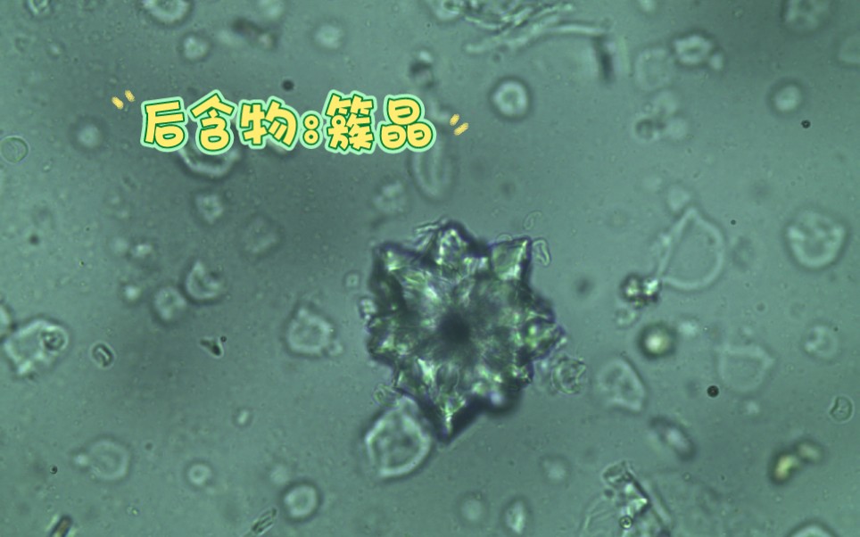 药用植物学显微实验:后含物