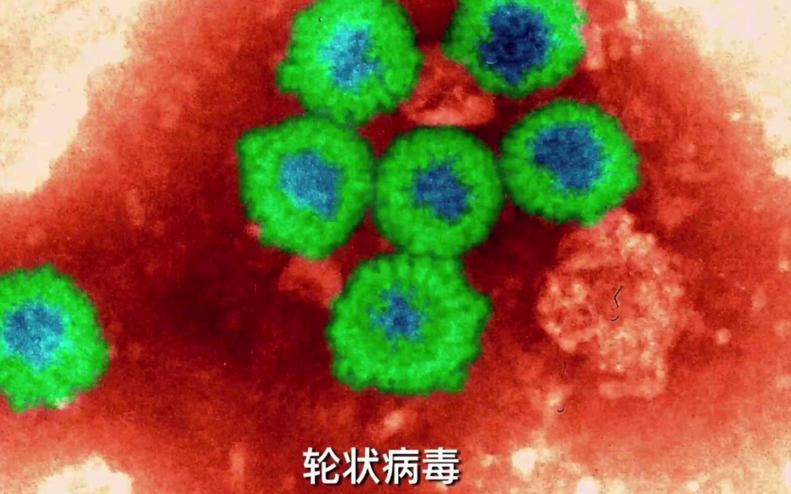 电子显微镜下的病毒,一个我们看不到的微观世界