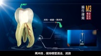 益锐M3 M3-2016-2017机用镍钛根管锉(热激活)-操作说明