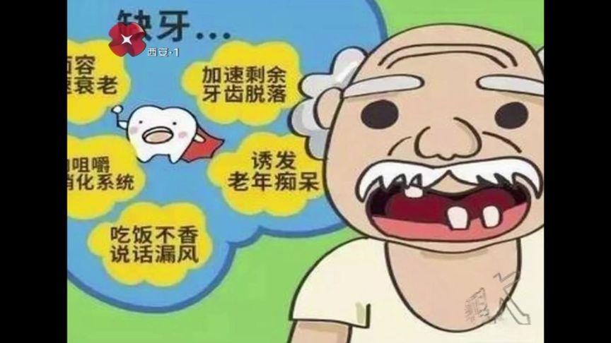 种植牙的费用很高吗?品牌不同收费不同,一般价格在几千元