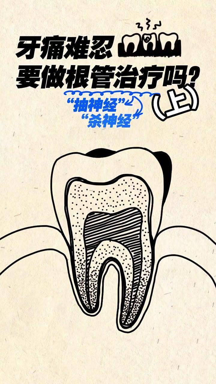 牙痛难忍!要做根管治疗吗?(上)#药健康