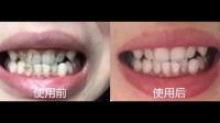 净态氧系清洁懒人神器衣物净 秒去霉杀菌.清洗水果安全到食品级! 只需...