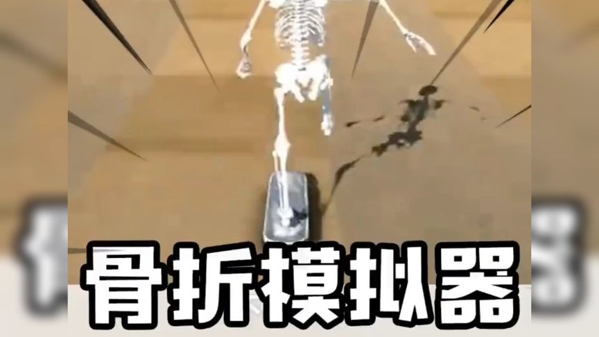 花里胡哨滑板?不!这是骨折模拟器!#游戏#滑板