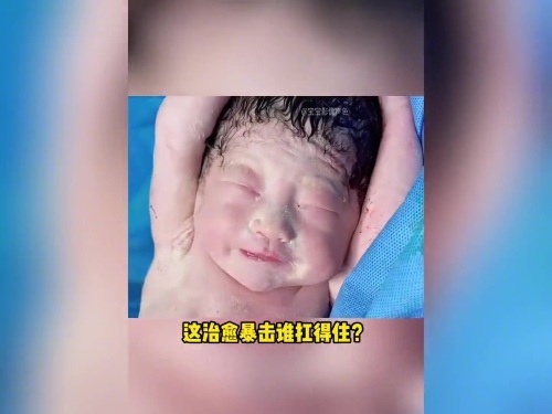 医生都看懵了!宝宝出生时一个动作,整个产房都笑翻了!