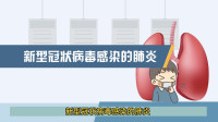 新型冠状病毒感染有哪些症状?我们又该如何预防?