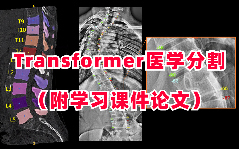 同济大学计算机博士手把手教你录代码!一次讲透【Transformer在医学...
