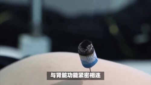 艾灸涌泉穴:一穴解百乏,睡眠差的人都在偷偷用!