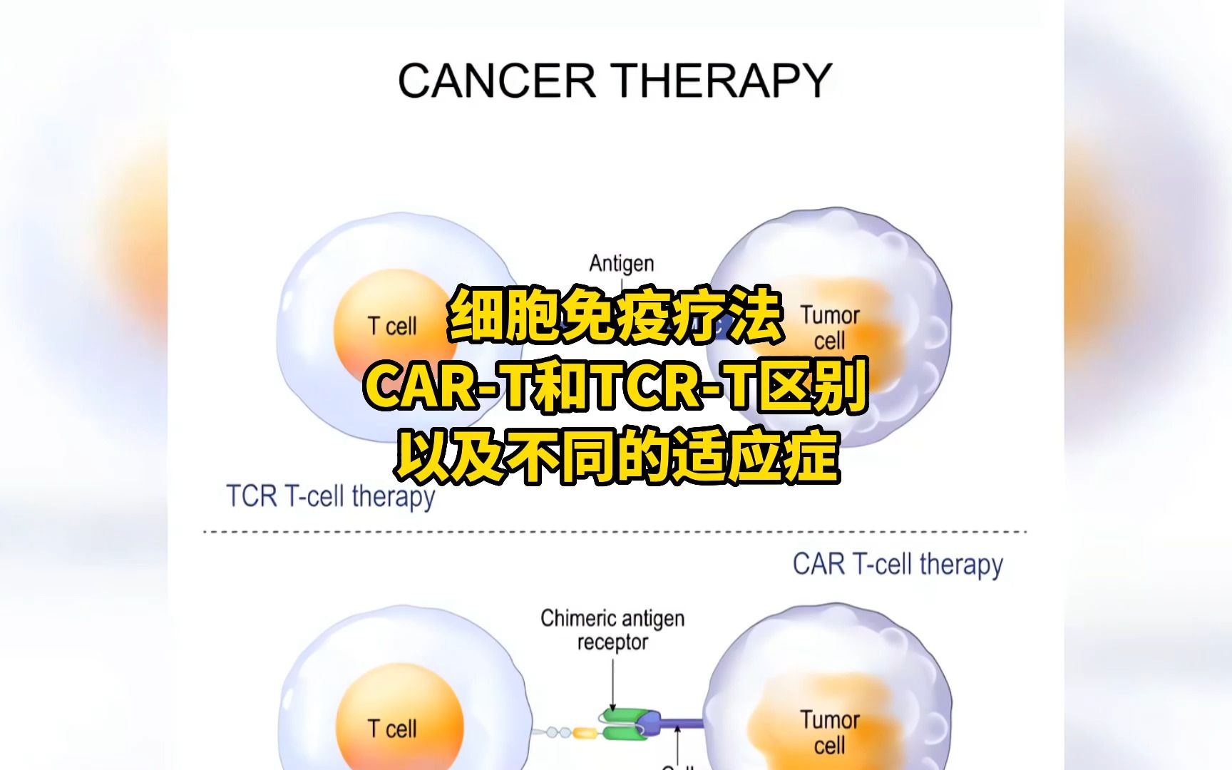 细胞免疫疗法CAR-T和TCR-T的区别,以及不同的适应症