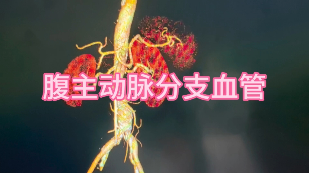 腹主动脉分支血管!当年我也是看了很多遍才记住!一起来看看吧!