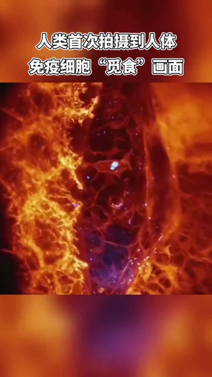 科技:人类首次拍摄到,人体免疫细胞吞噬细菌的过程