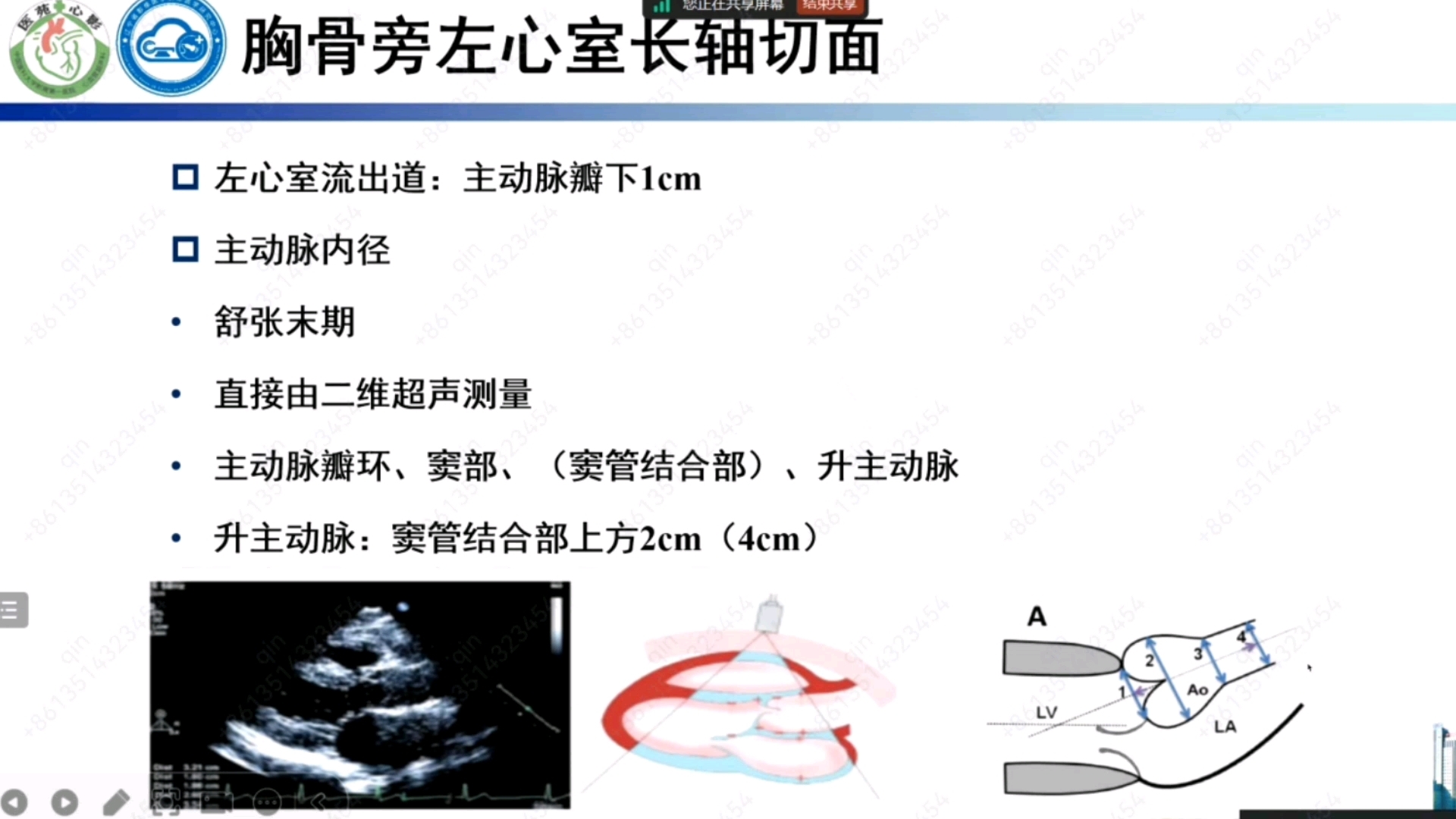 【自用】超声心动图规范化测量及正常值