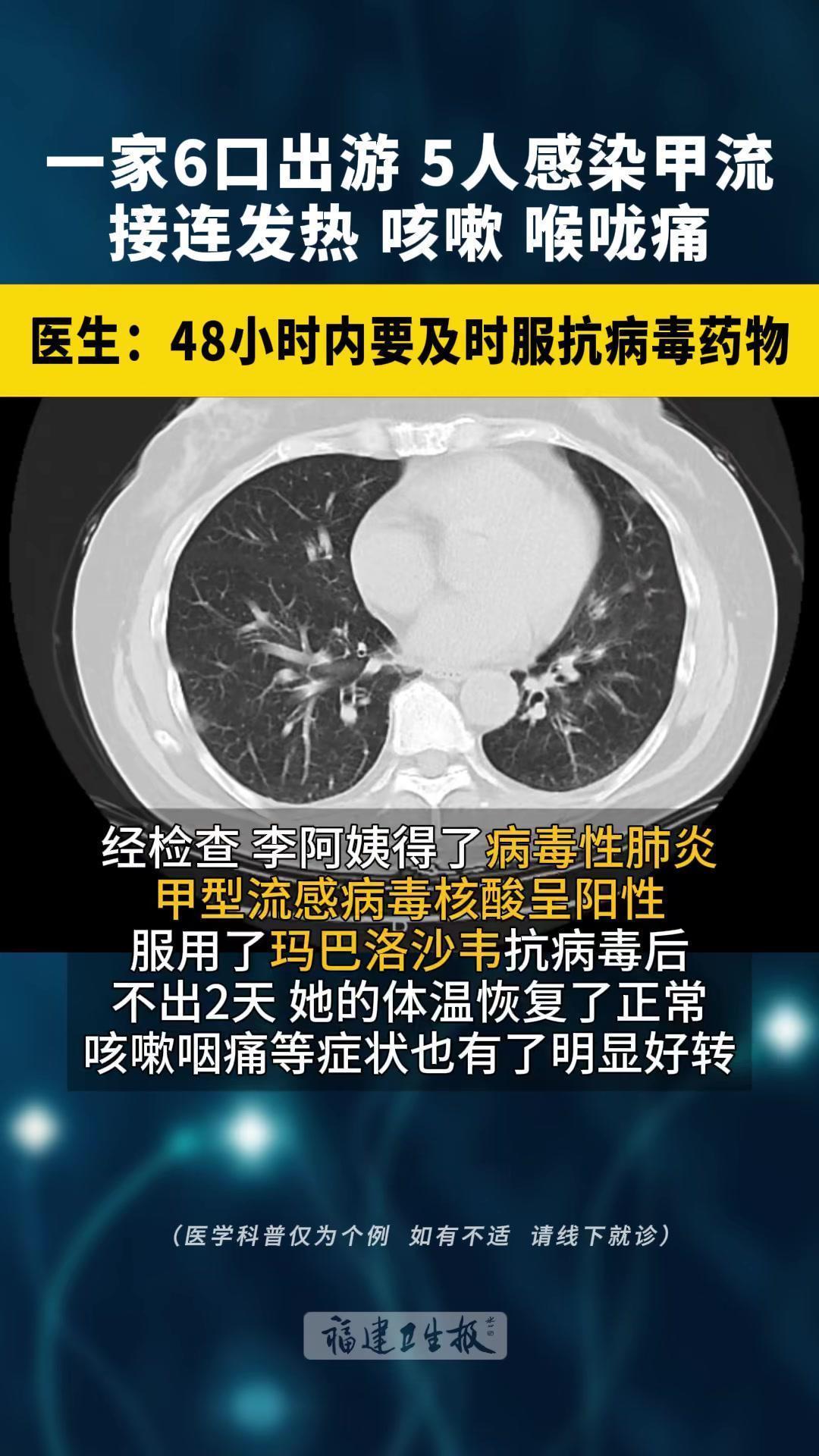 #浙江一家6口出游,5人感染#甲流,接连#发热、#咳嗽、#喉咙痛,#医生:...