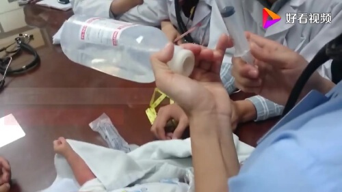 护士示范怎么用针筒给婴儿喂食,准爸妈可以了解一下