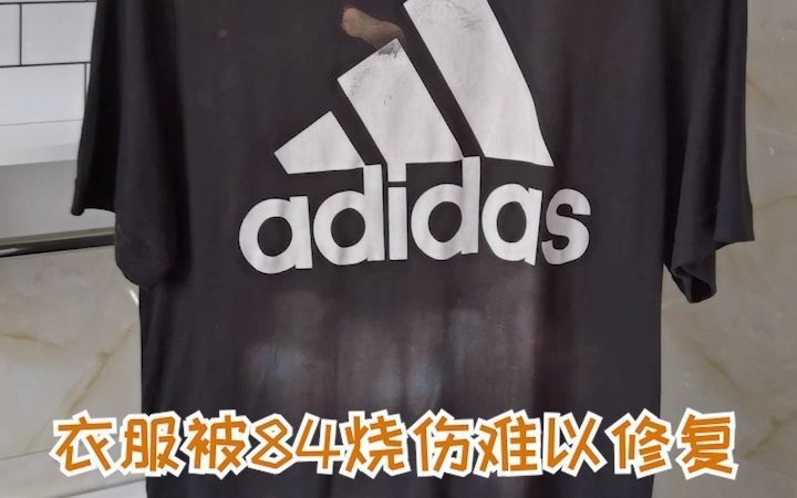 衣服被84消毒剂烧伤了咋办