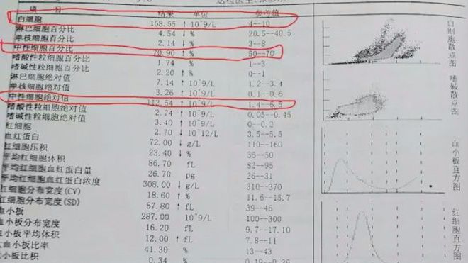 白血病的血常规指标怎么看?主要看哪三方面?
