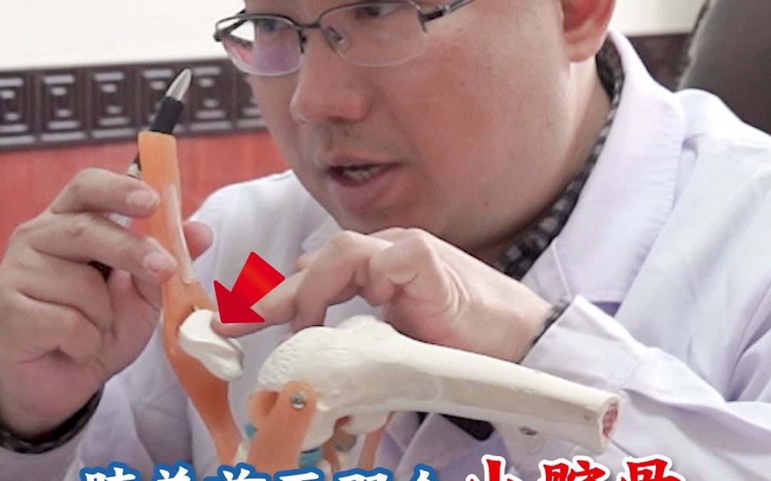 半月板2级损伤,软骨退化严重,好好保守治疗