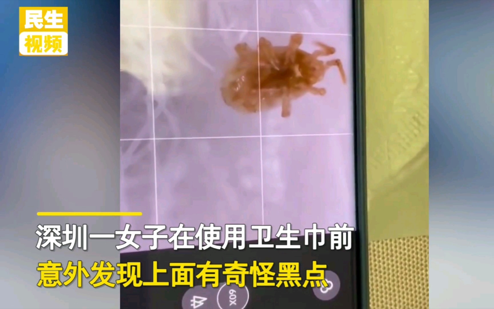 女子用手机显微镜发现卫生巾有虫,客服:需要进一步核实