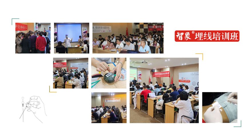 智象穴位埋线培训长效针灸埋线疗法埋线针靓紫丝线.mp4