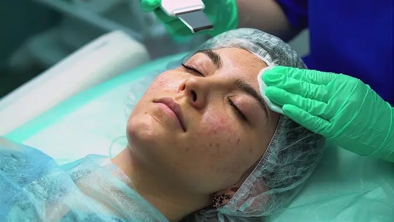 女子为美尝试黄金微针
