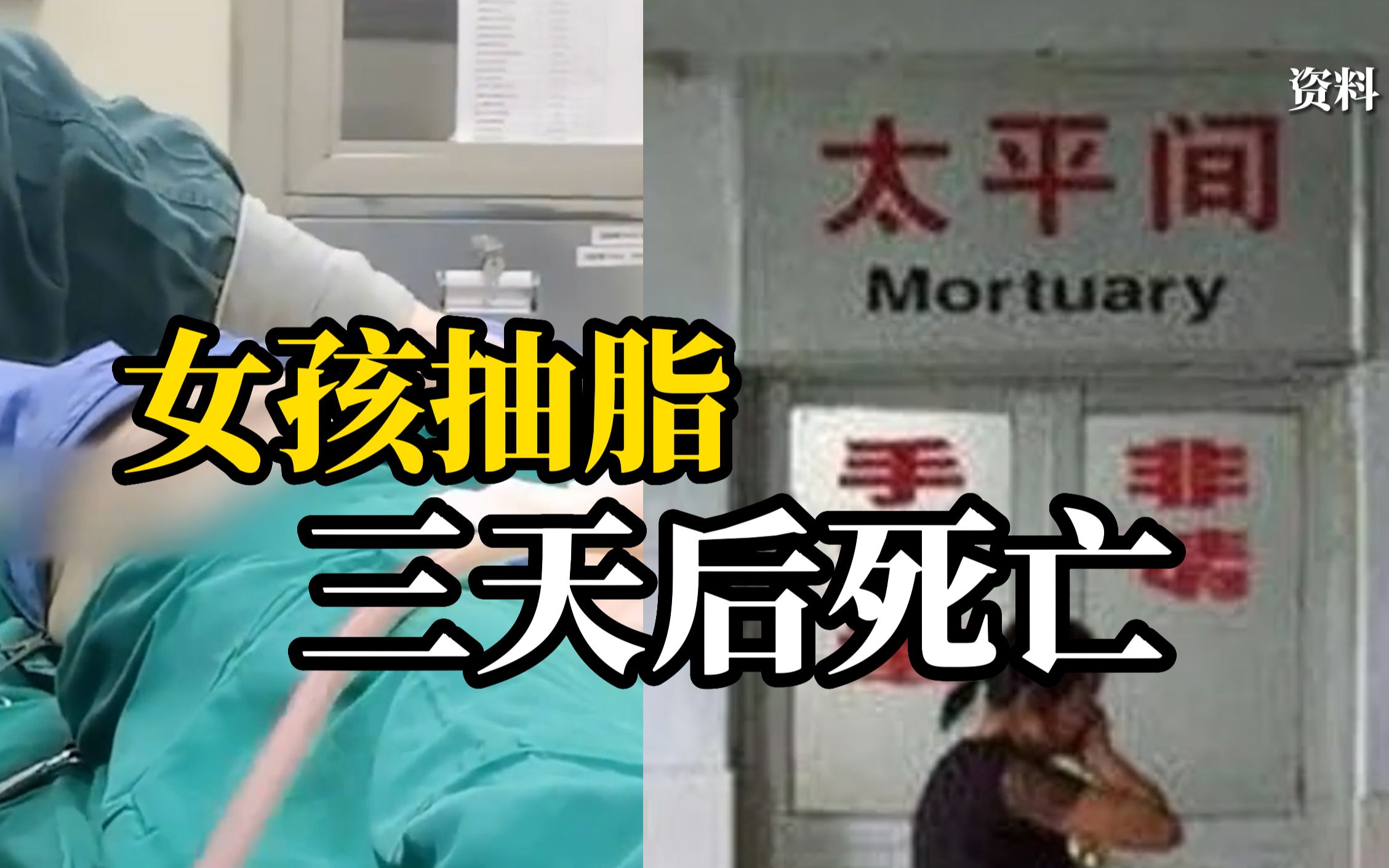 19岁女孩瞒着父母做抽脂,术后3天死亡。抽脂医生竟是助理,最终被判...