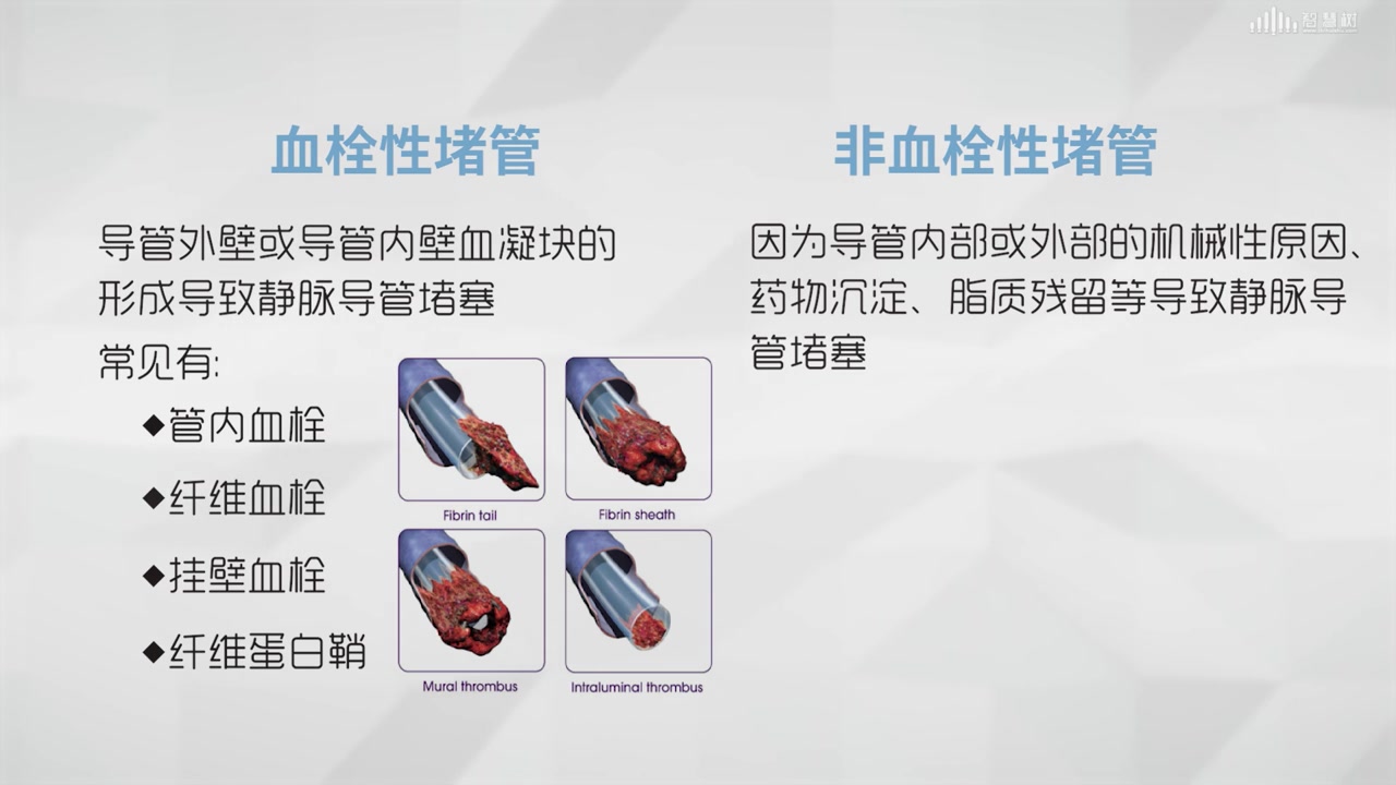 《静脉治疗专科护理知识与技能》--中山大学