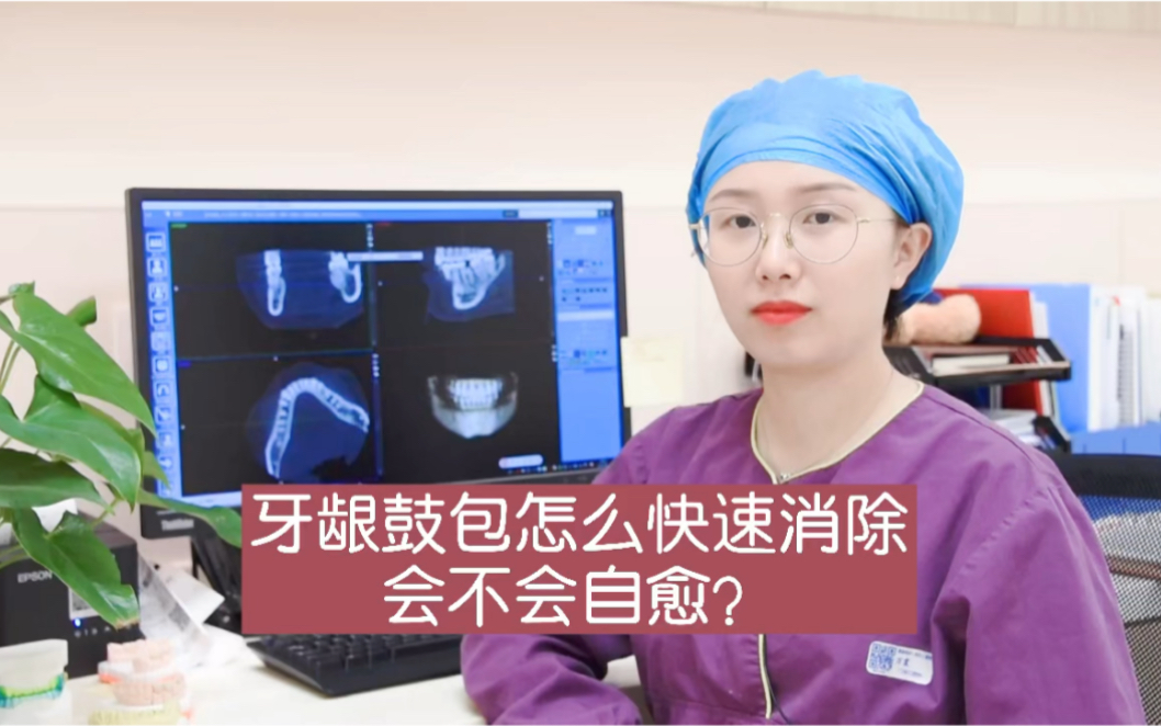 牙龈鼓包怎么快速消除会不会自愈?