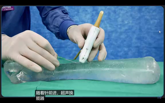 超声引导桡动脉穿刺置管