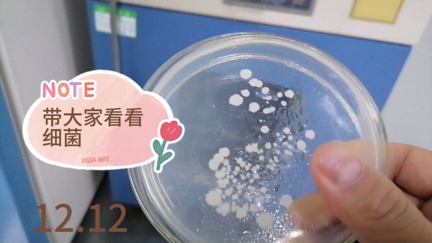 今天我们一起看一下我们手部细菌,然后你就知道问为什么要勤洗手