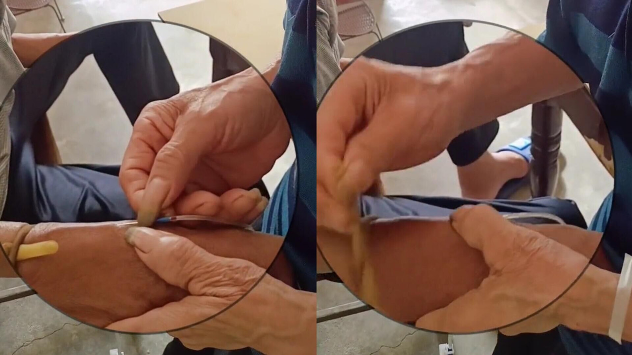 老医生给病人扎针时双手狂抖,被扎的病人却一脸淡定,网友害怕了