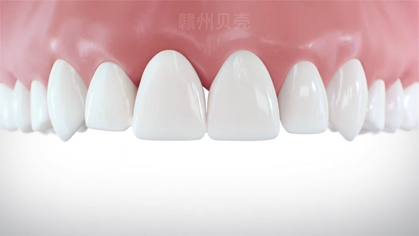 2分钟了解种植牙全过程