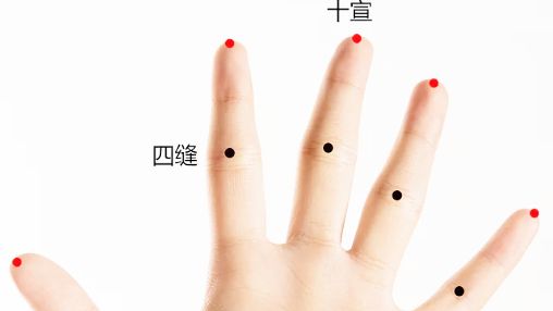 十宣穴的位置,穴位疗法,功效及主治病症