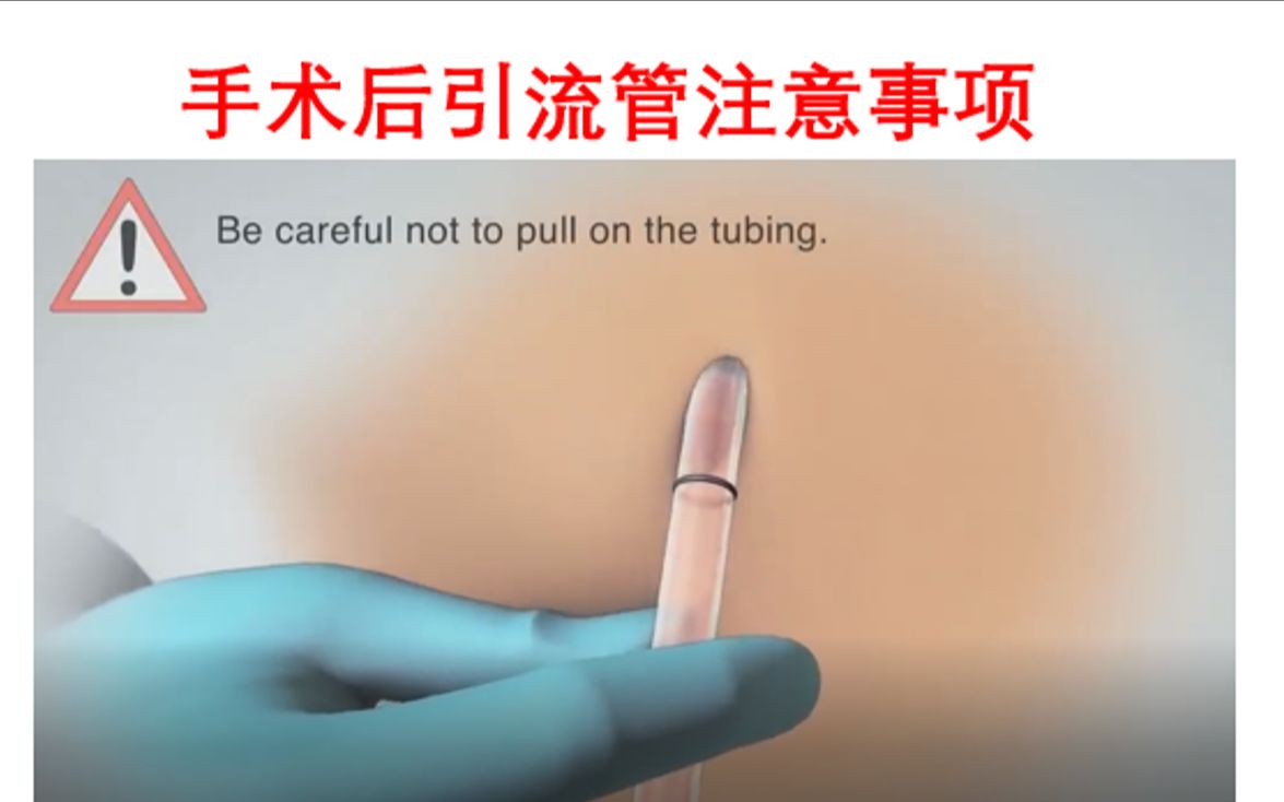 【Nucleus医学科普】手术后引流管注意事项
