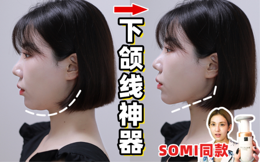 32岁自用10年|somi同款瘦下巴瘦脸器 正确用法使用心得