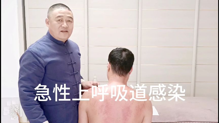 刮刮痧也能对急性上呼吸道感染有保健预防的作用